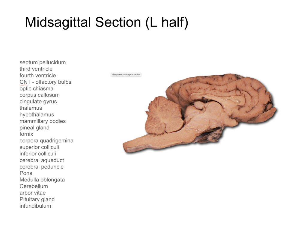 Solved Midsagittal Section (L half) Sheep brain, midsagittal | Chegg.com