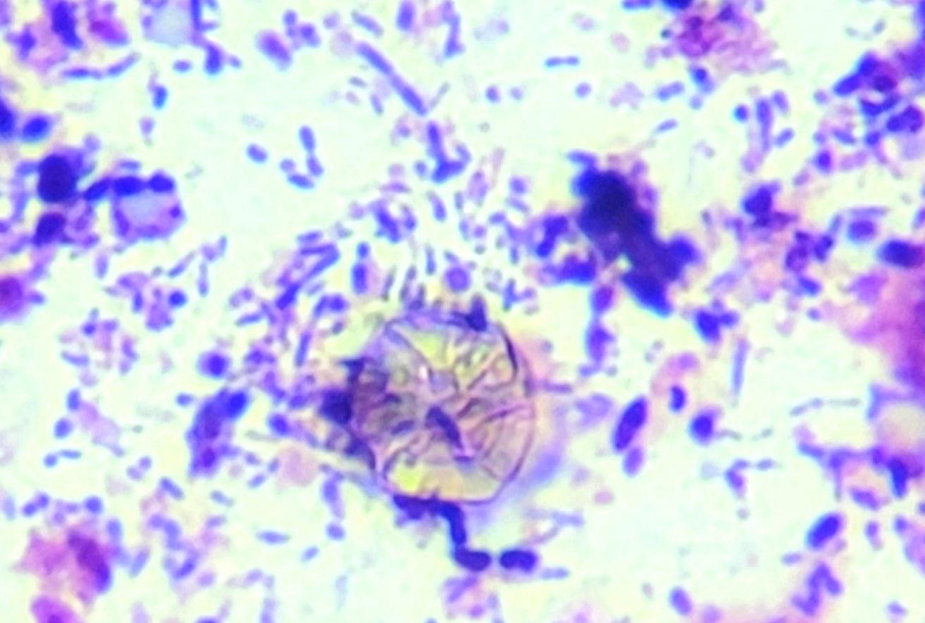 Solved What do white blood cells look like in a fecal gram | Chegg.com