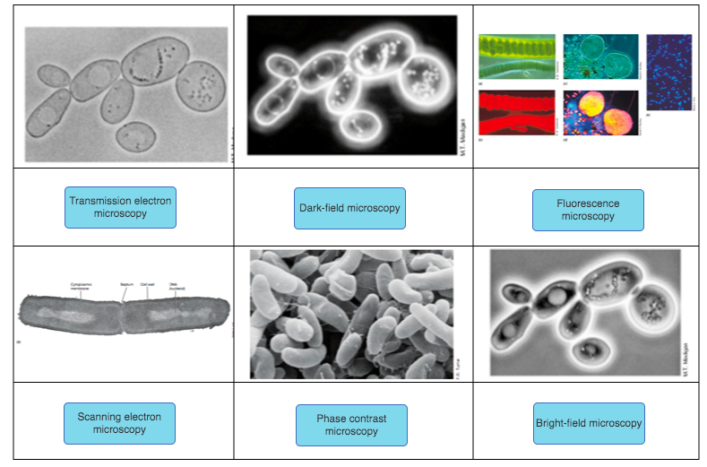 Solved Types of Microscopic Images Drag the choices below to | Chegg.com Solved Types of Microscopic Images Drag the choices below to | Chegg.com