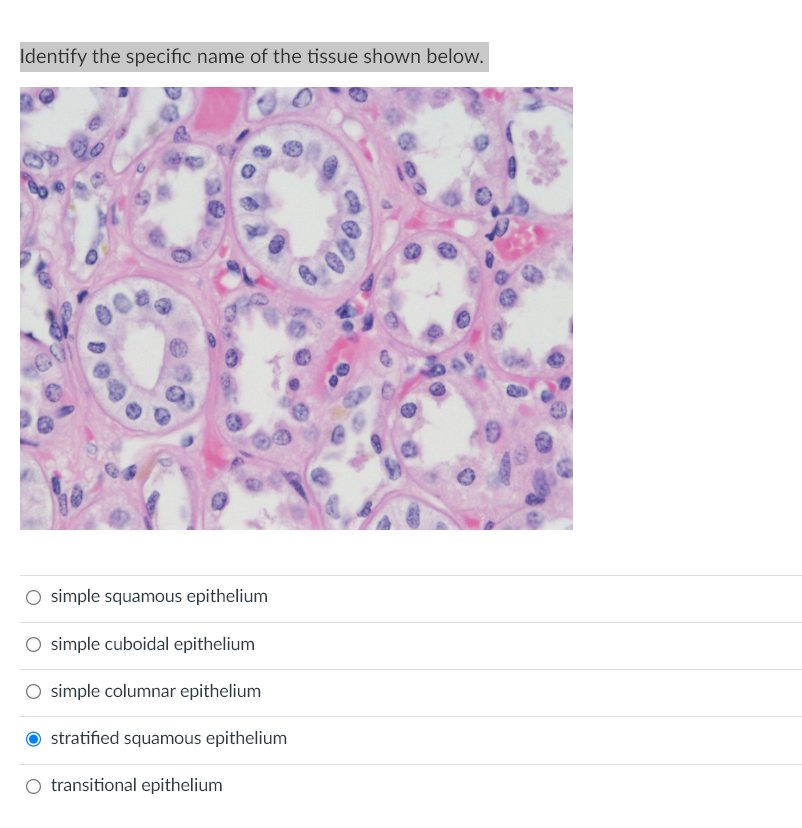 Solved Identify the specific name of the tissue shown | Chegg.com
