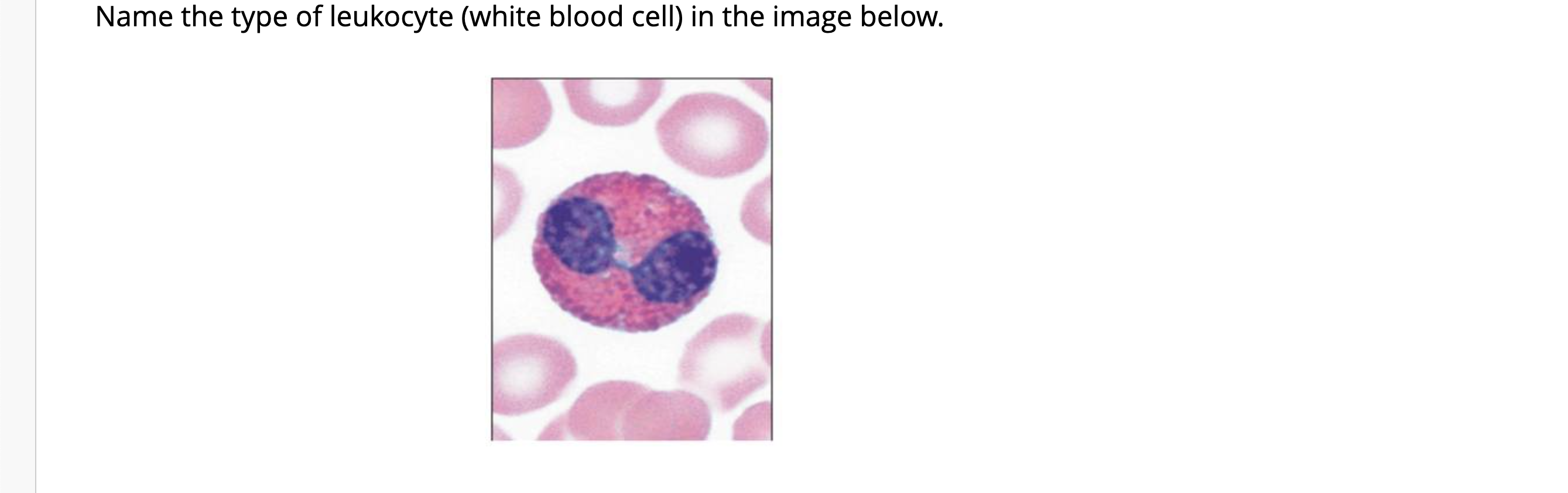 Solved Name the type of leukocyte (white blood cell) in the | Chegg.com