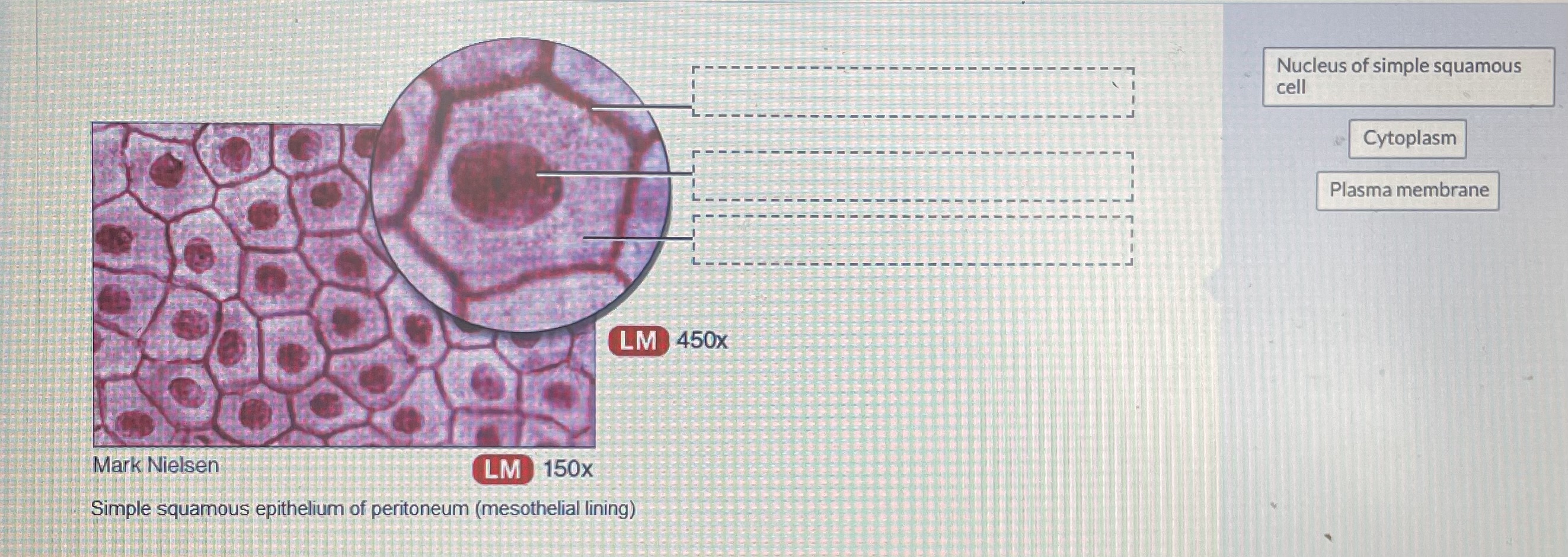 Solved Simple squamous epithelium of peritoneum (mesothelial | Chegg.com