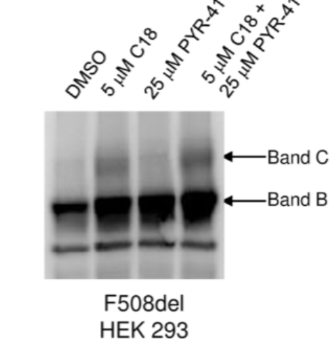 Solved Western blot of HEK 293 ﻿cell lysates treated with | Chegg.com