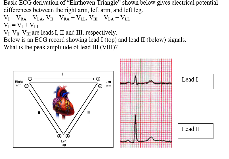 Solved Basic ECG derivation of "Einthoven Triangle” shown | Chegg.com