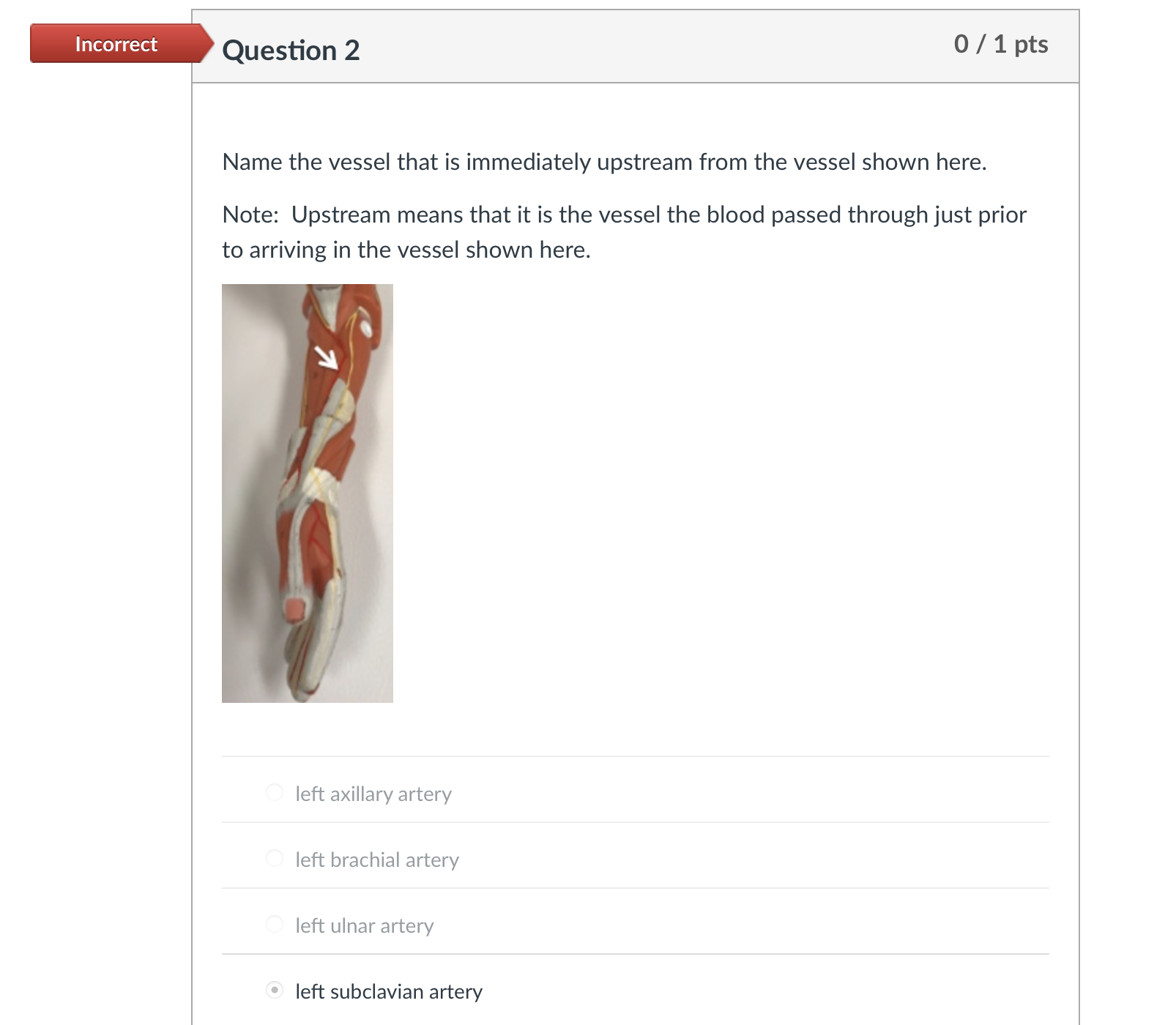 Solved by an EXPERT Question 2Name the vessel that is immediately | Chegg.com