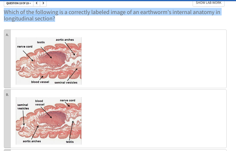 Solved QUESTION 13 OF 23> SHOW LAB WORK Which of the | Chegg.com