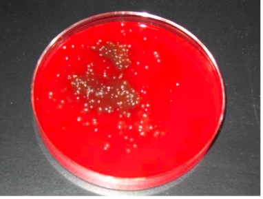Solved beta-hemolysis Streptococcus pyogenes alpha | Chegg.com