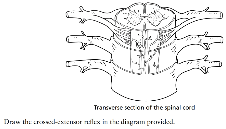 Solved Transverse section of the spinal cord Draw the | Chegg.com