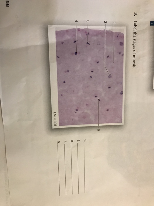 Solved xercise 2· Label I the cell division photos. 1. | Chegg.com Solved xercise 2· Label I the cell division photos. 1. | Chegg.com
