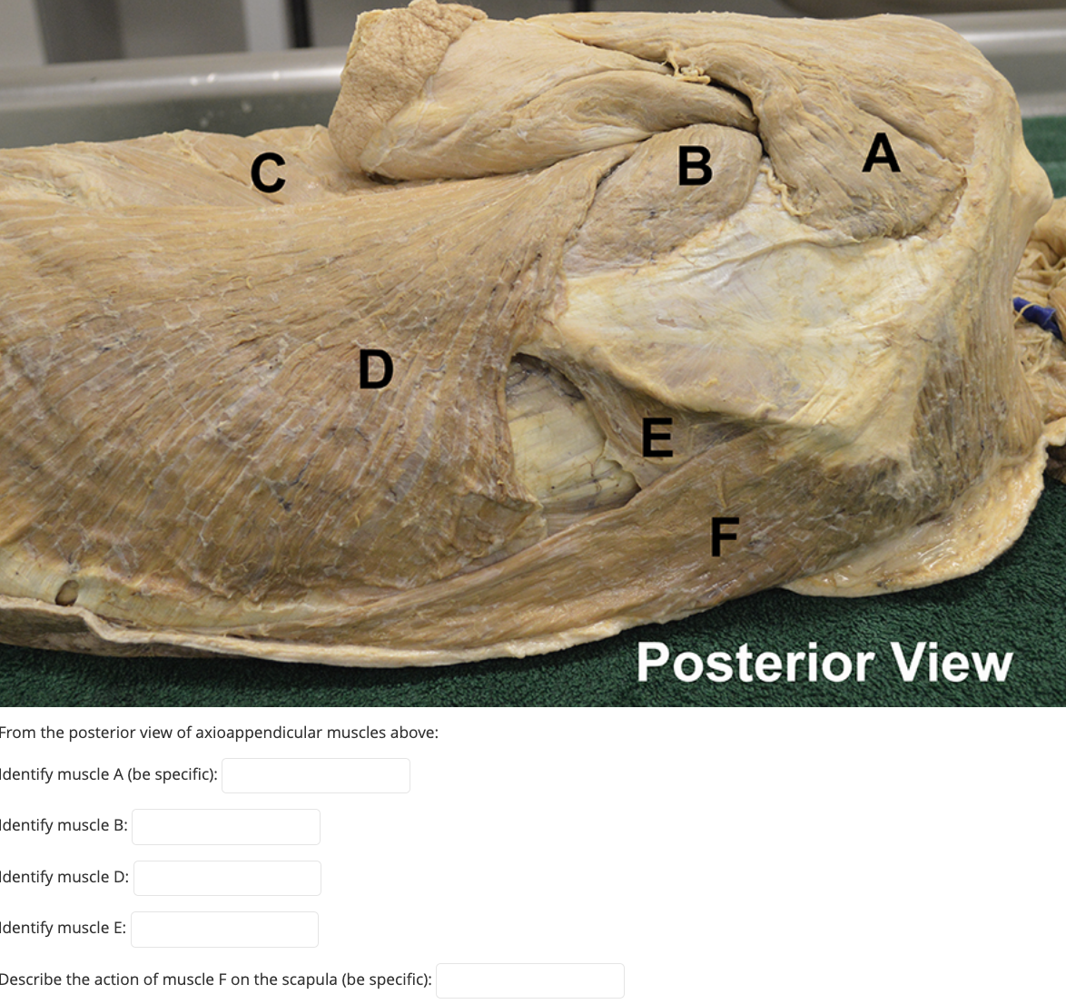 Solved rom the posterior view of axioappendicular muscles | Chegg.com