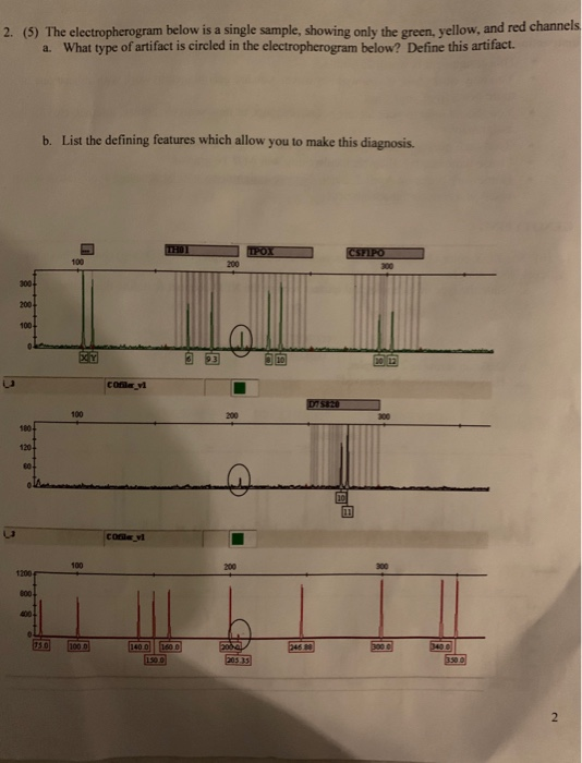 Solved 2. (5) The electropherogram below is a single sample, | Chegg.com