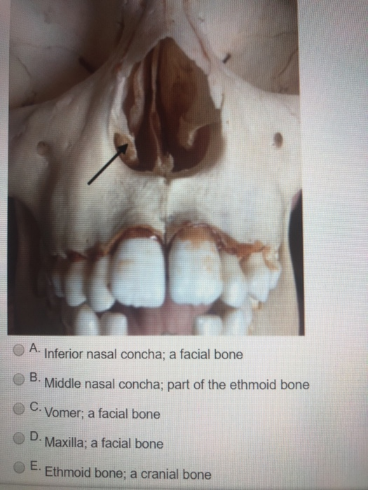 Inferior Nasal Concha