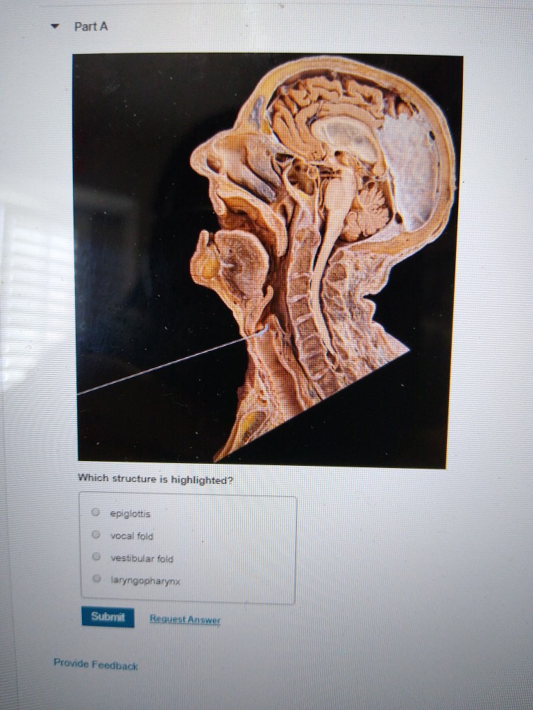 Solved Part A Which structure is highlighted? O o right main | Chegg.com