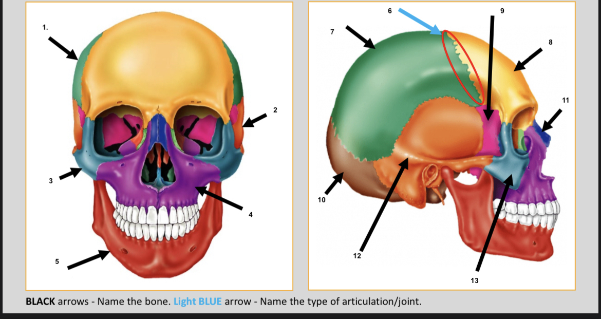 Solved **BLACK arrows - Name the bone** Light BLUE arrow - | Chegg.com