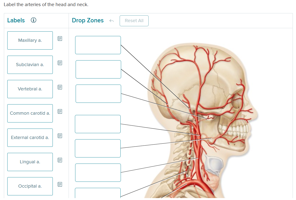 Solved Label the arteries of the head and neck. | Chegg.com