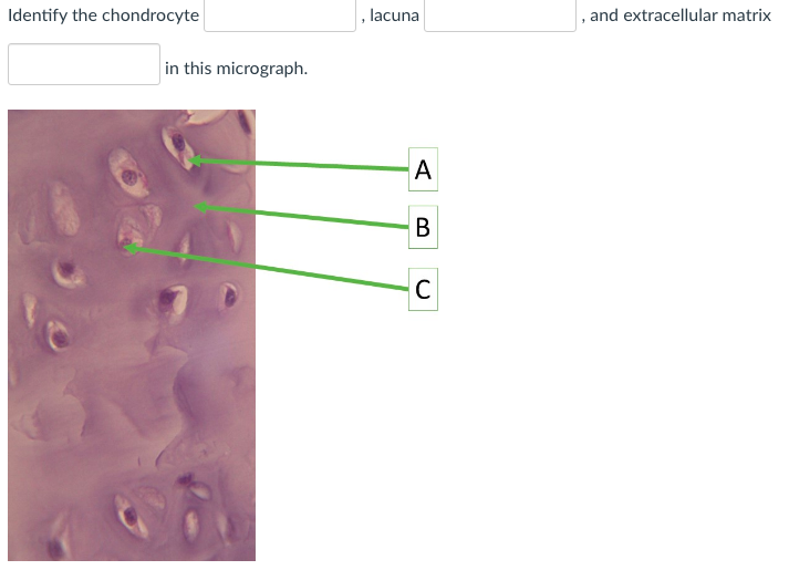 Solved Identify the chondrocyte , lacuna , and extracellular | Chegg.com