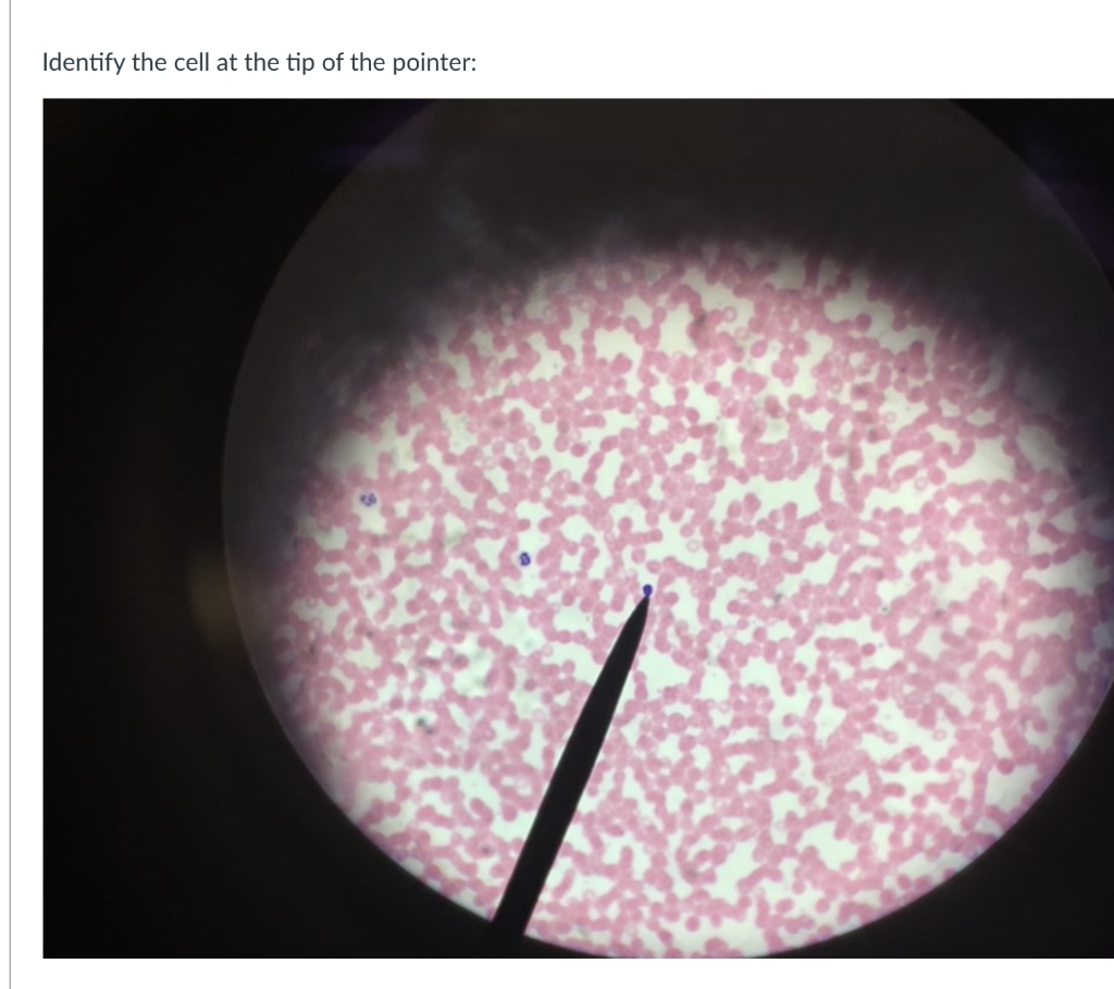 Solved Identify the structure at the tip of the pointer: | Chegg.com