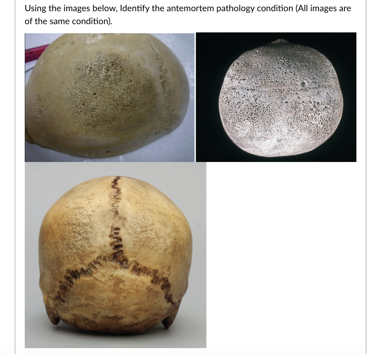 Solved Using the images below, Identify the antemortem | Chegg.com