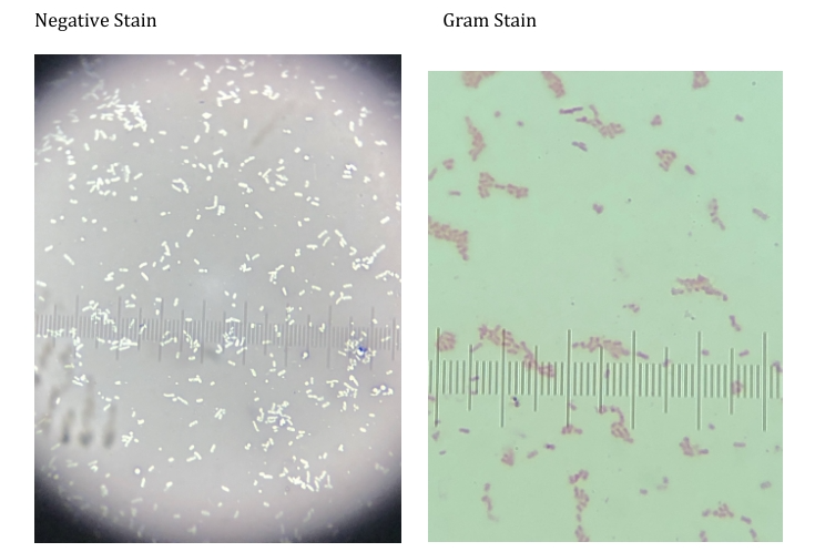 Solved Find the unknown bacteria here using two tests and | Chegg.com