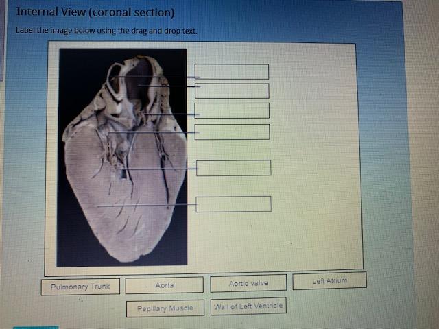 Solved Internal View (coronal section) Label the image below | Chegg.com