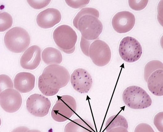 Solved ⊕ | Chegg.com