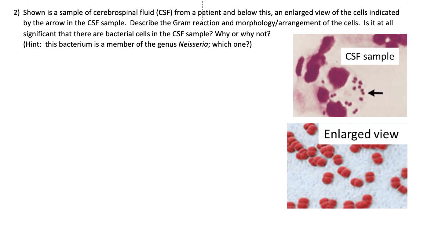 Solved 2) Shown is a sample of cerebrospinal fluid (CSF) | Chegg.com
