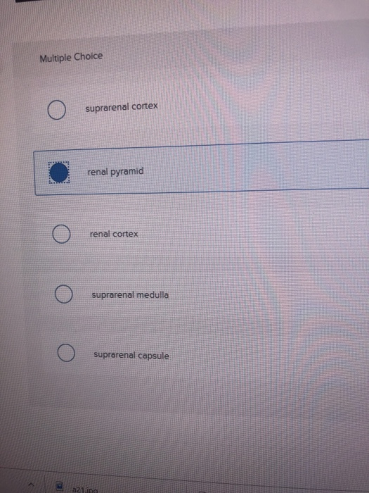 Solved Which structure is highlighted? Multiple Choice | Chegg.com Solved Which structure is highlighted? Multiple Choice | Chegg.com
