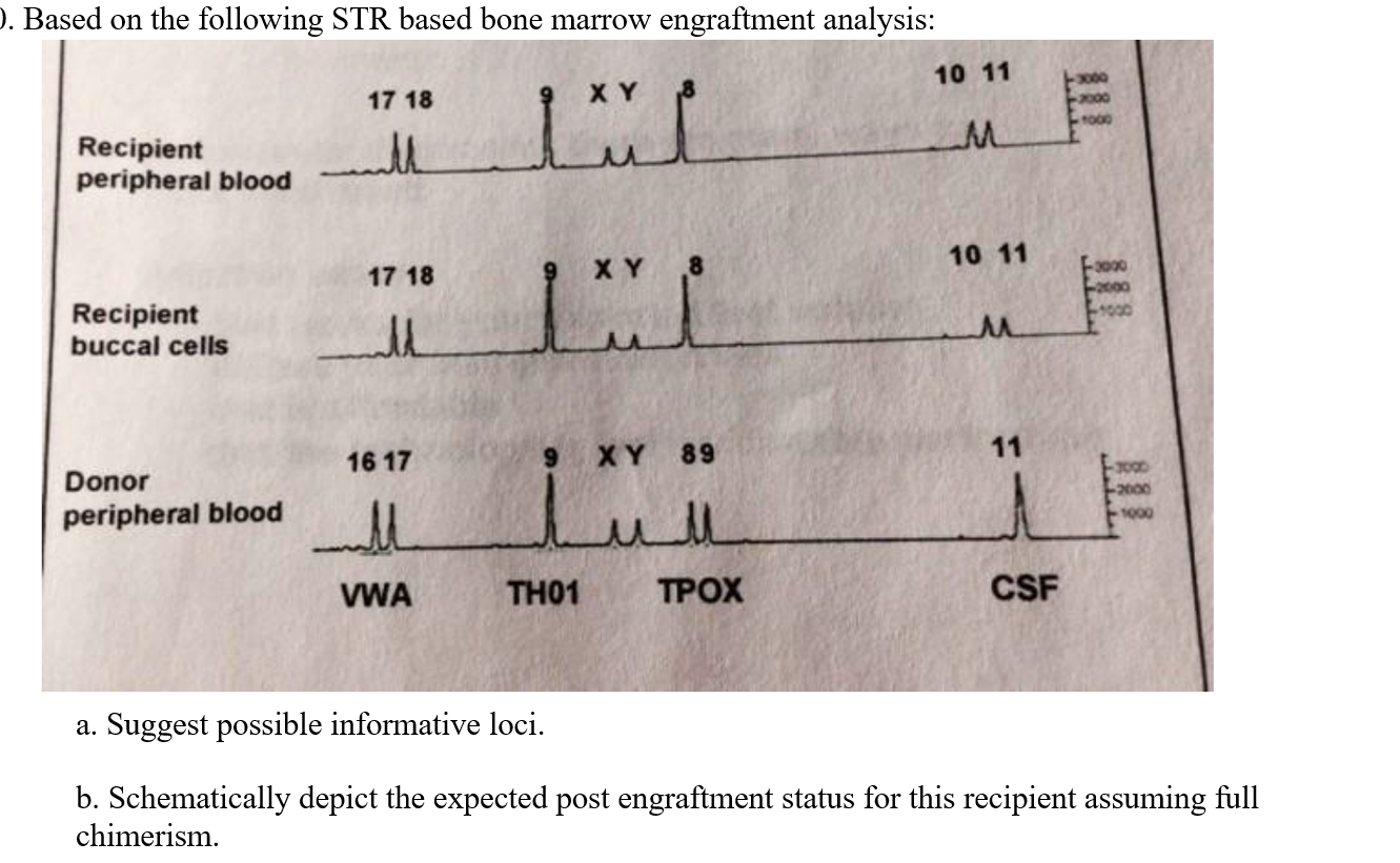 Solved 5. Based on the following STR based bone marrow | Chegg.com