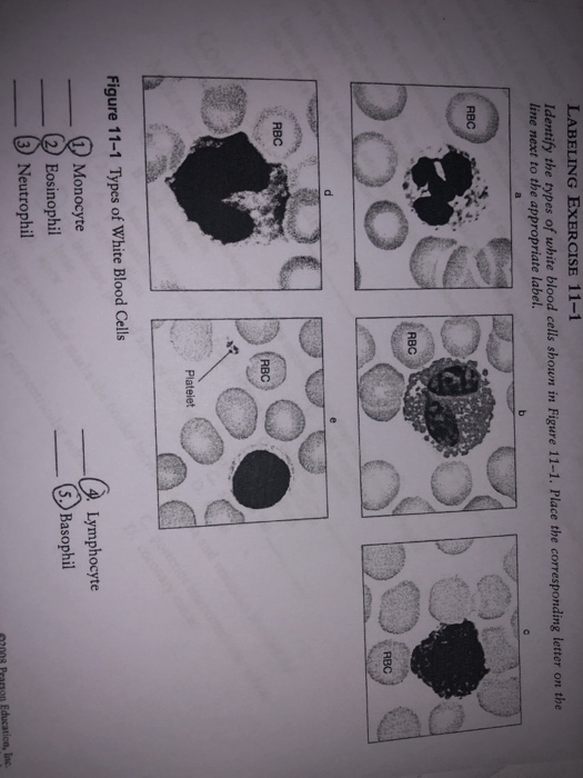 Solved LABELING EXERCISE 11-1 Identify the types of white | Chegg.com