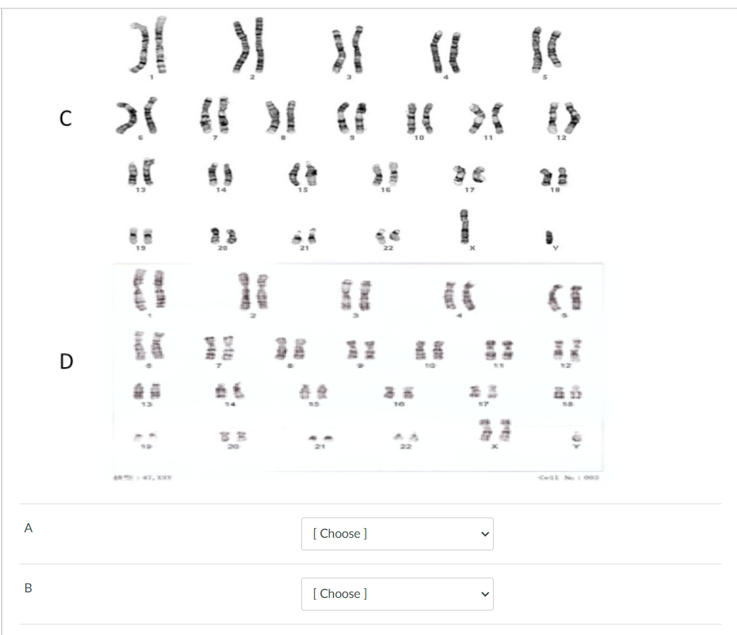 Solved Shown are 4 Karyotypes; match each to the chromosomal | Chegg.com
