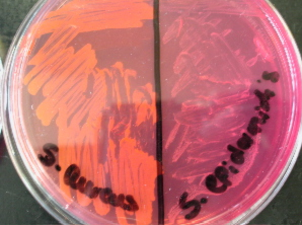 Using Differential, Selective, and Enriched Media 14 | Chegg.com