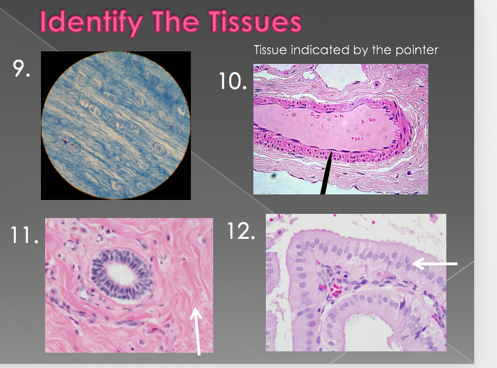 Solved Identify The Tissues Tissue indicated by the pointer | Chegg.com