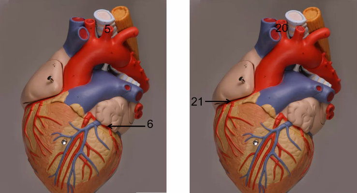 Solved 3B Heart & Lung Model Aorta Pulmonary artery | Chegg.com