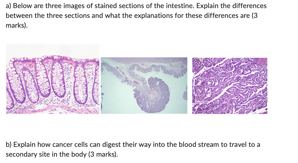 Solved a) Below are three images of stained sections of the | Chegg.com