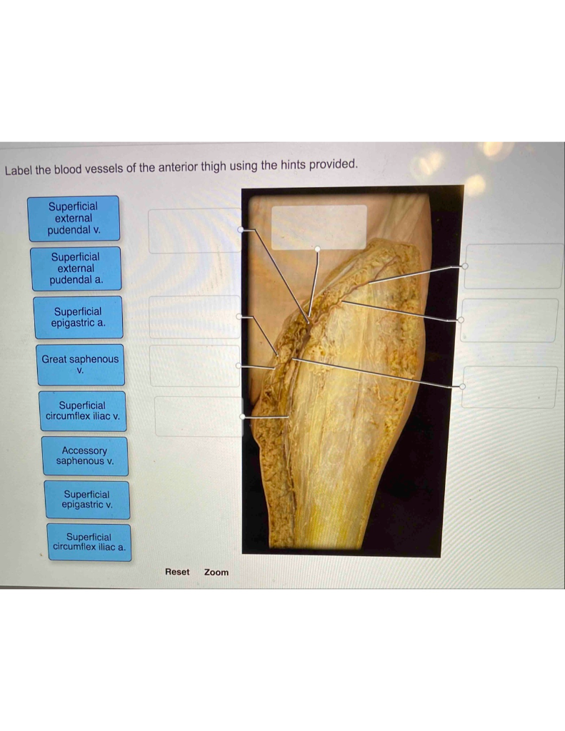 Solved Label the blood vessels of the anterior thigh using | Chegg.com