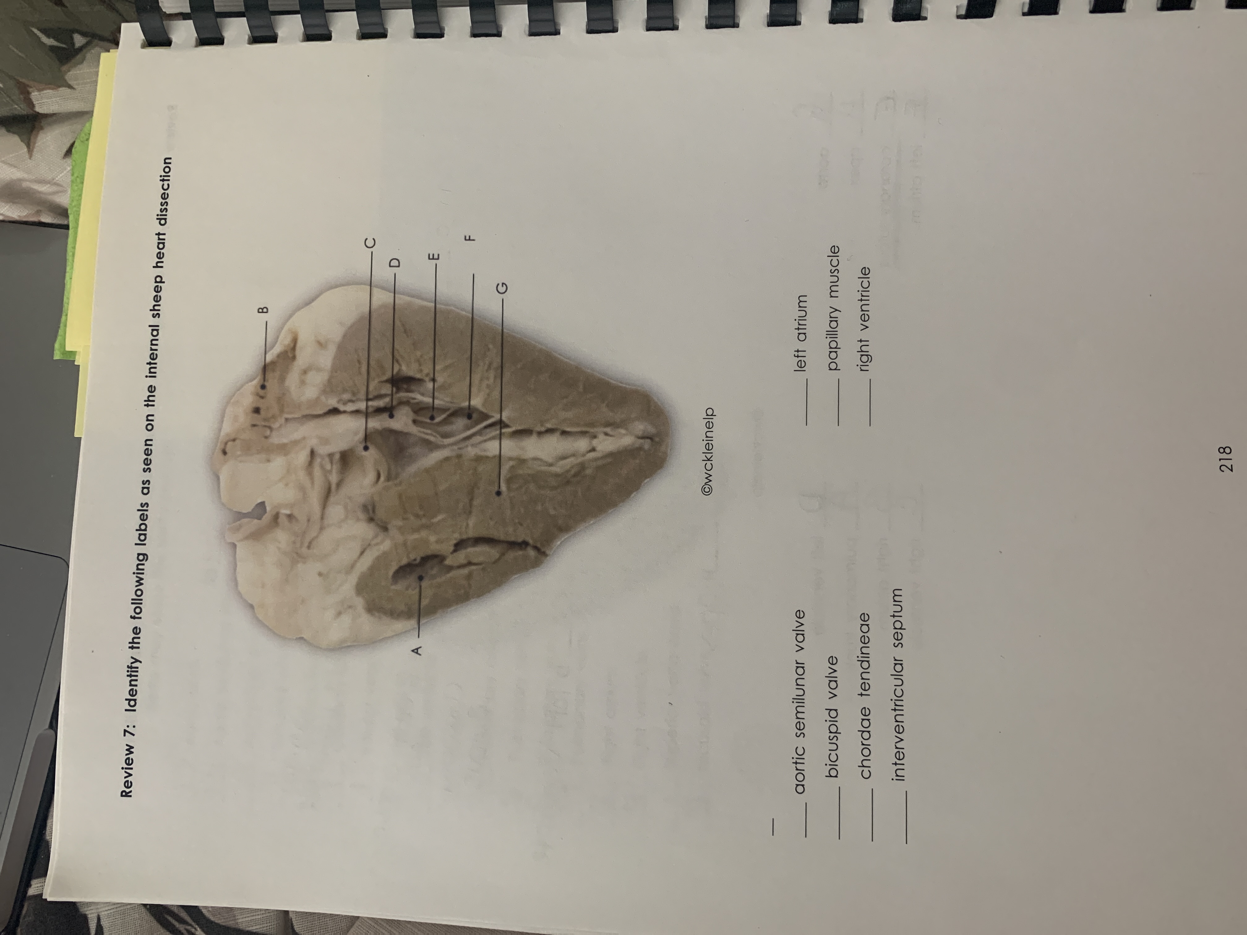 Solved Review 7: Identify the following labels as seen on | Chegg.com