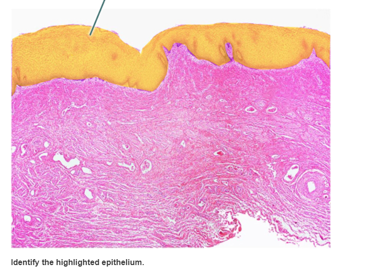 Solved Identify the highlighted epithelium. | Chegg.com