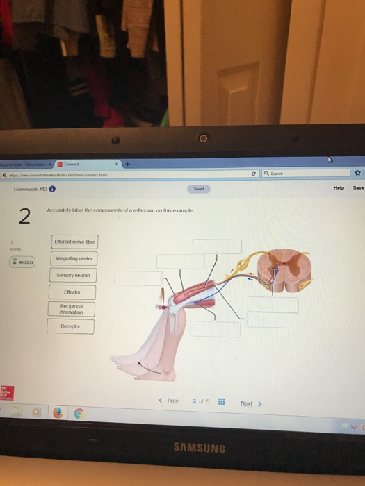 Solved Accurately label the components of a reflex arc on | Chegg.com