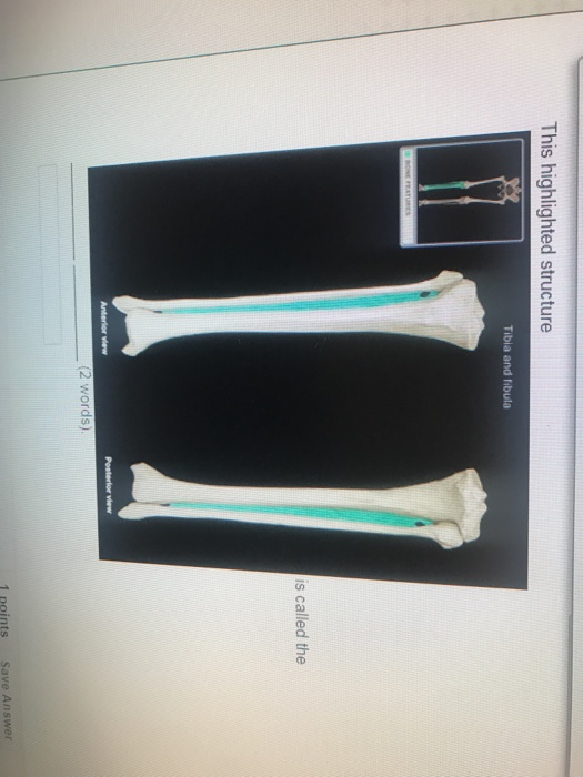 Solved This highlighted structure Tibia and fibula is called | Chegg.com