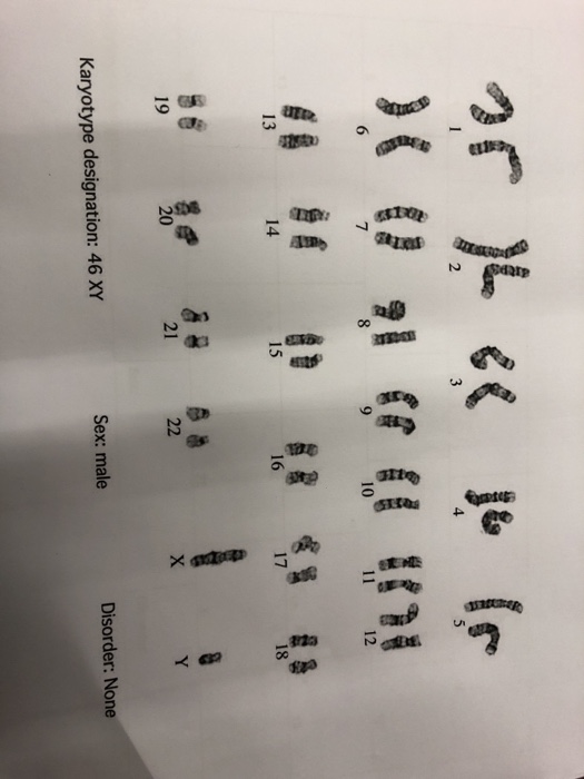 Solved In picture one it shows a sample of a karyotype | Chegg.com
