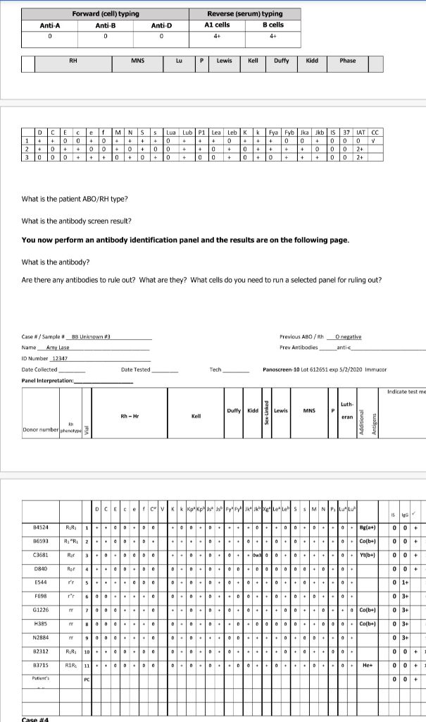 Solved Forward (cell) typing Anti-B Reverse (serum) typing | Chegg.com
