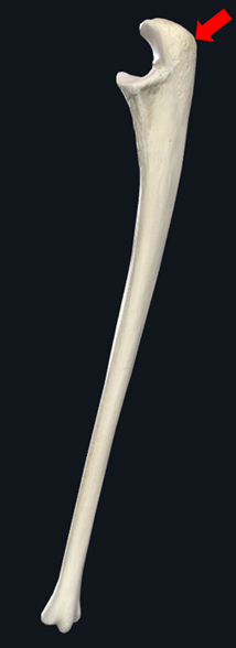 Solved The arrow is pointing to the __________ of the ulna | Chegg.com