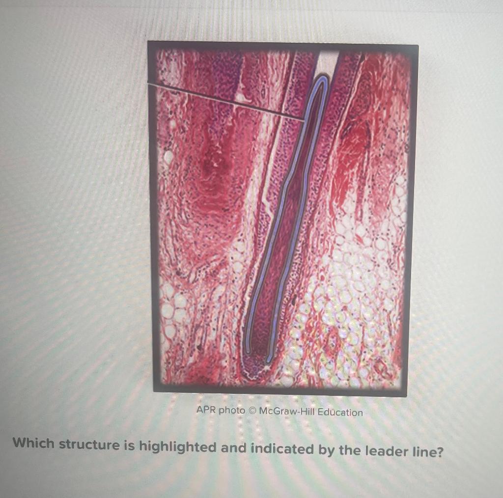 Solved glass membrane cortex internal root sheath | Chegg.com