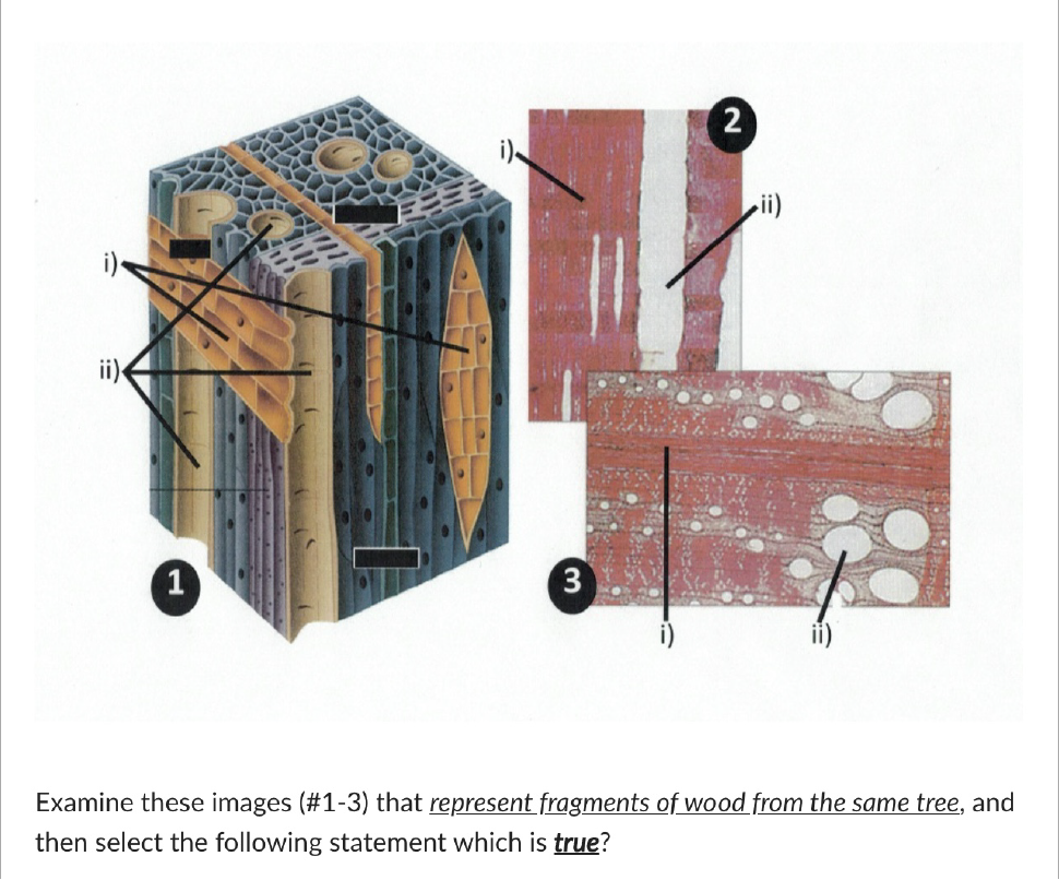 Solved The structures labelled 'i' are vessel members | Chegg.com
