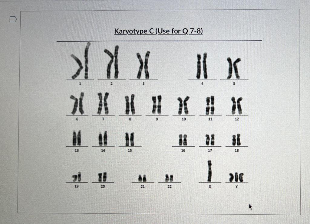 Solved Karyotype C (Use for Q 7-8) 21 Il X 2 3 5 10 11 12 38 | Chegg.com