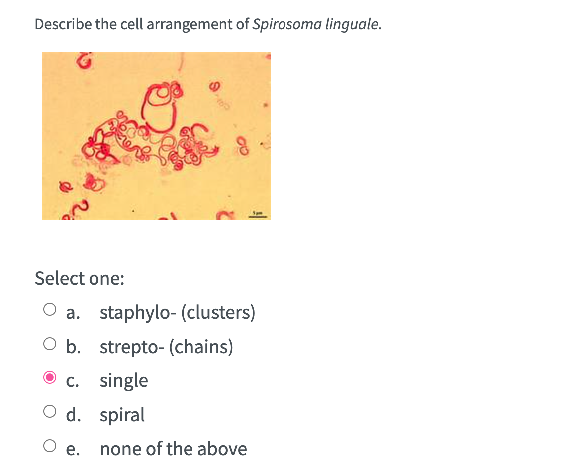 Solved Describe the cell arrangement of Spirosoma linguale. | Chegg.com