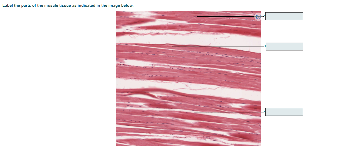 Solved Label the parts of the muscle tissue as indicated in | Chegg.com