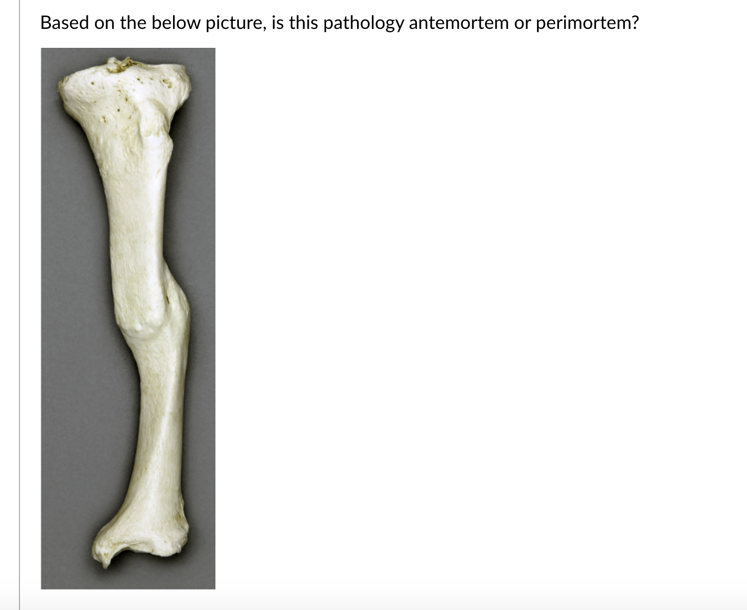 Solved Based on the below picture, is this pathology | Chegg.com