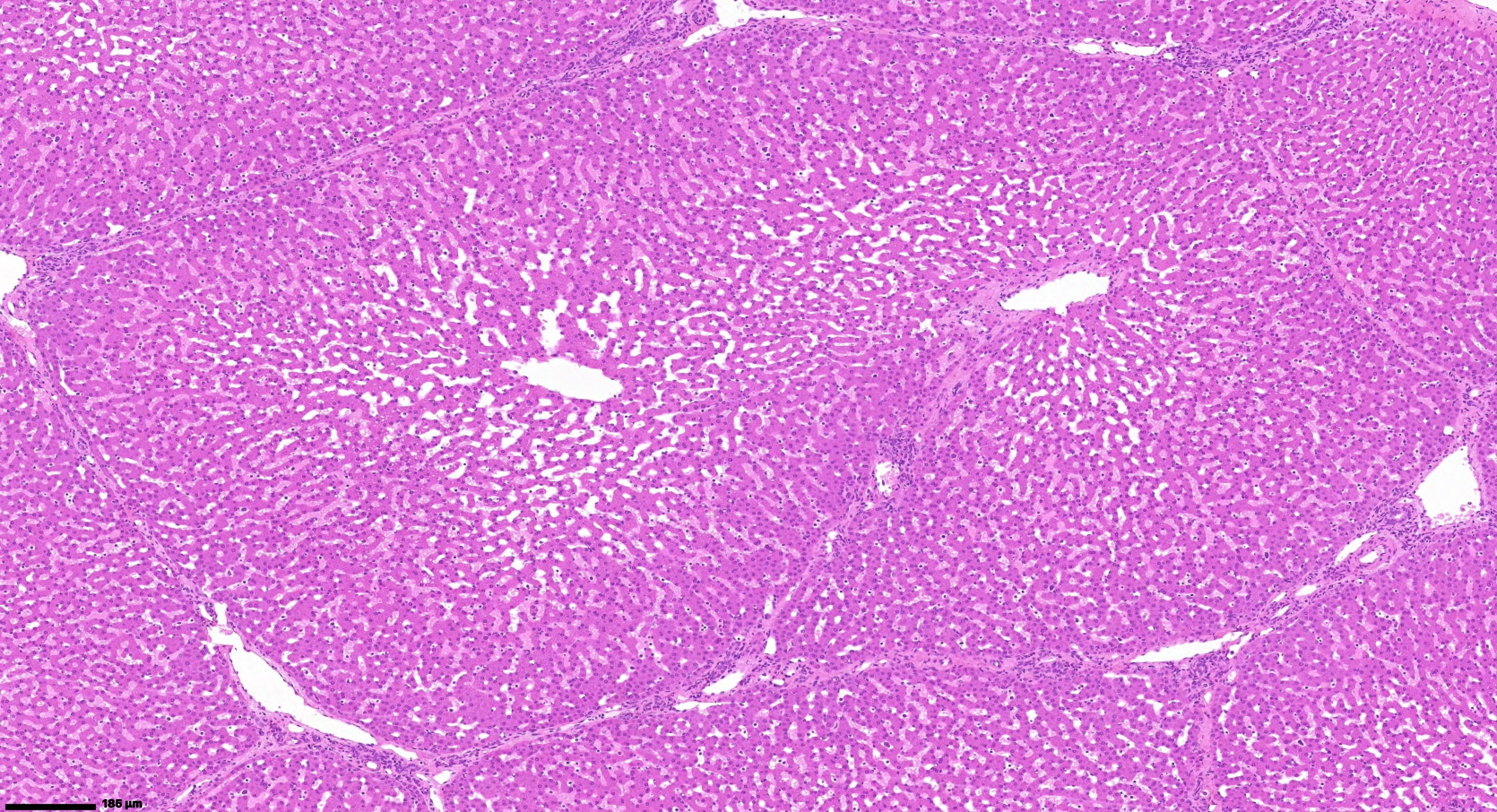 Solved I need help distinguishing the hepatic lobules, | Chegg.com