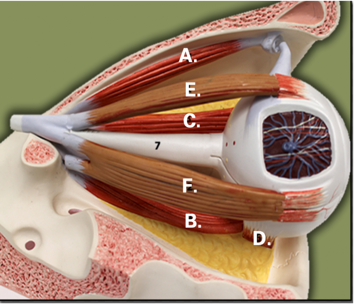 Name the muscle labelled A and What cranial nerve | Chegg.com